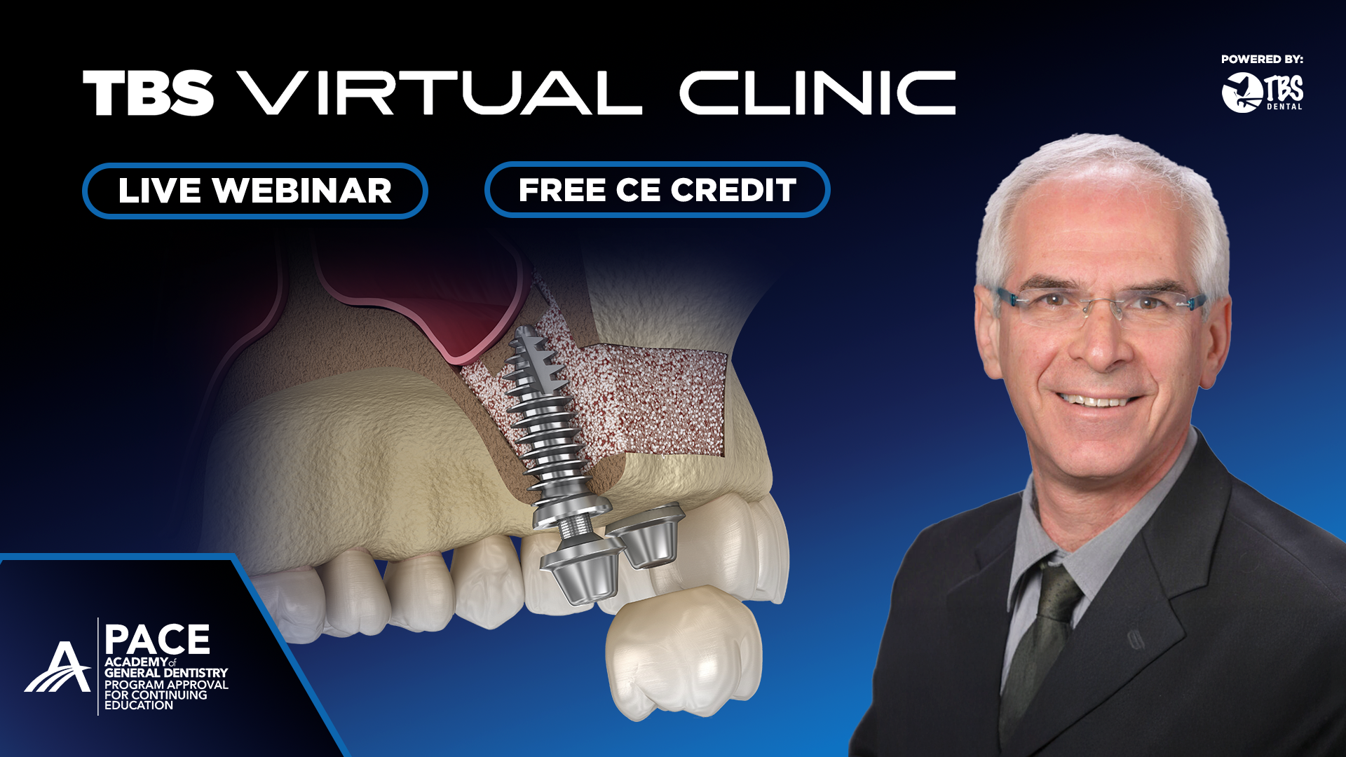 Sinus Lift Mastery: Complications & Solutions